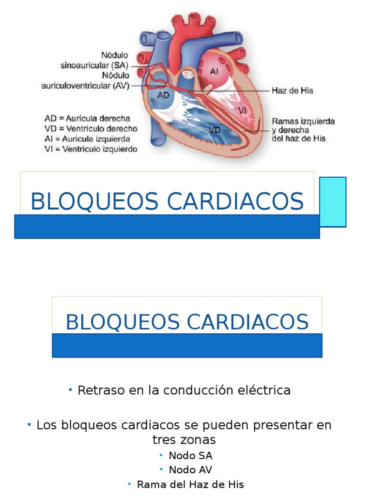 bloqueos ekg | Electrocardiografia | Cardiología