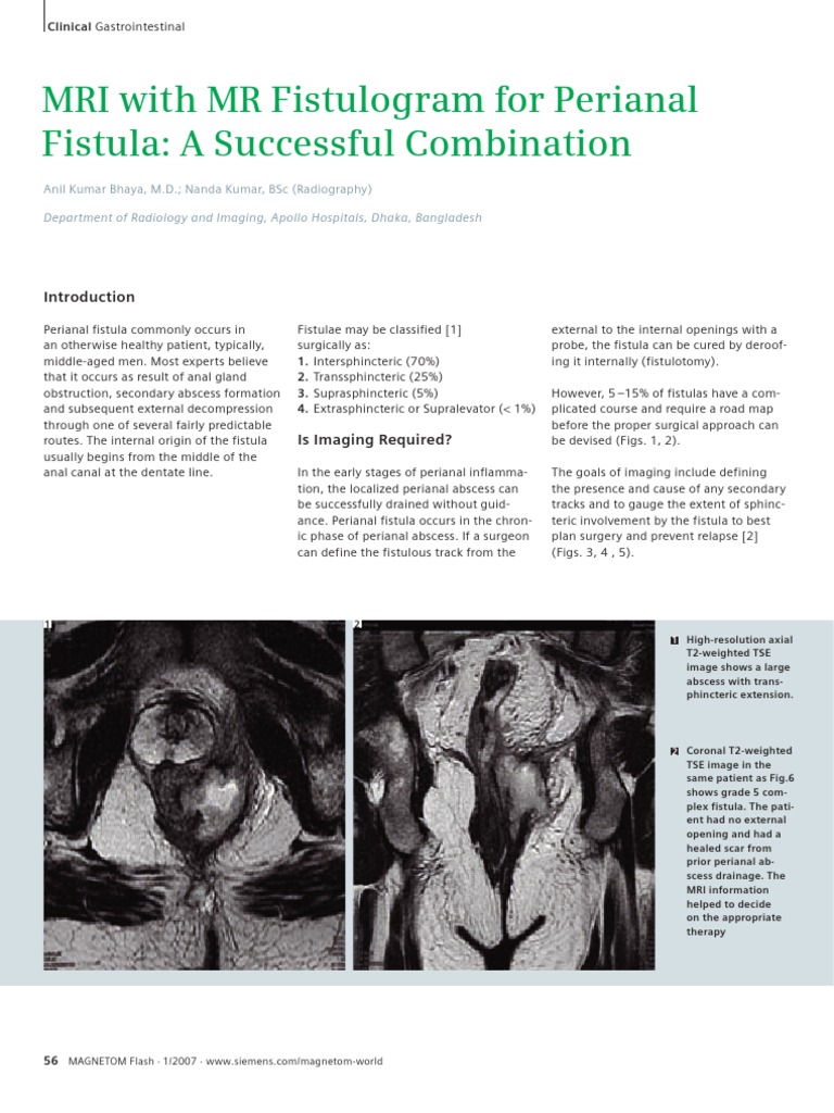 MRI With MR Fistulogram For Perianal Fistula - A Successful Combination ...