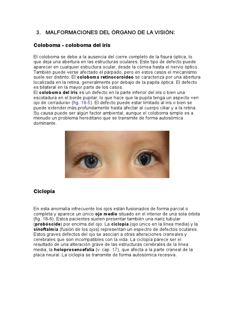 Malformaciones oculares: coloboma, ciclopía, microftalmía y anoftalmía | PDF | Ojo humano | Ojo