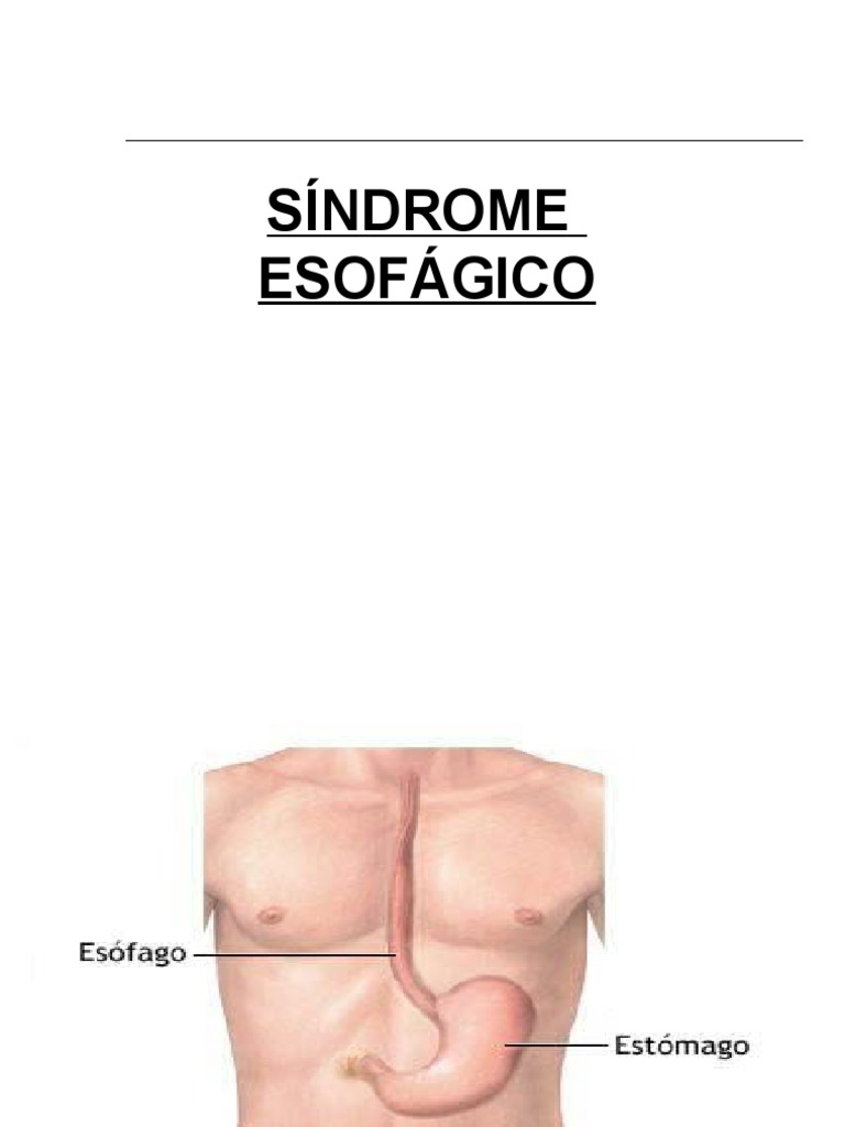 Síndrome esofagico | La enfermedad por reflujo gastroesofágico | Acidez