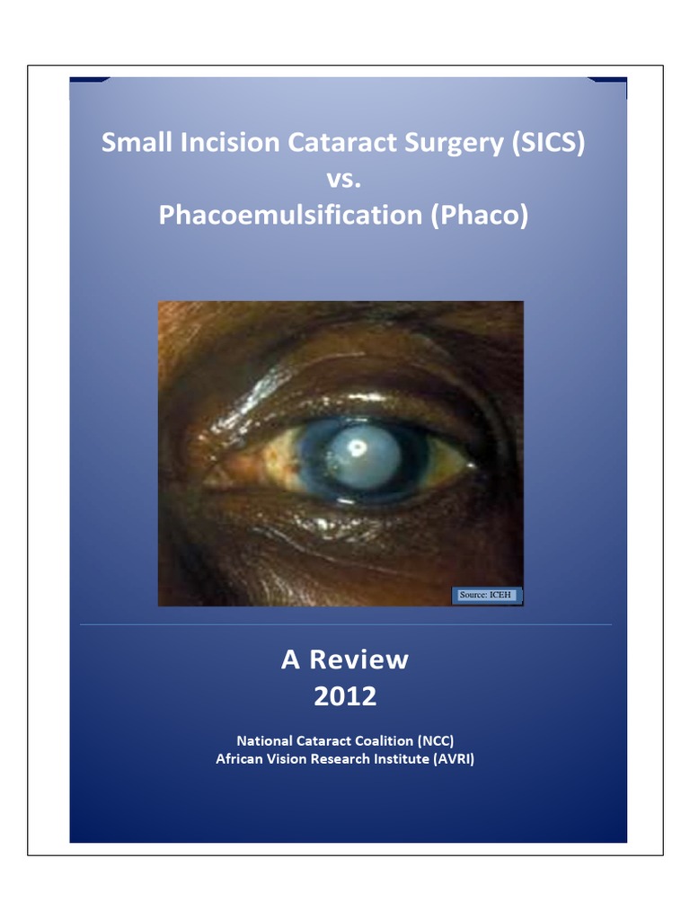 Sics vs. Phaco - A Reviewbbb | PDF | Ophthalmology | Surgery