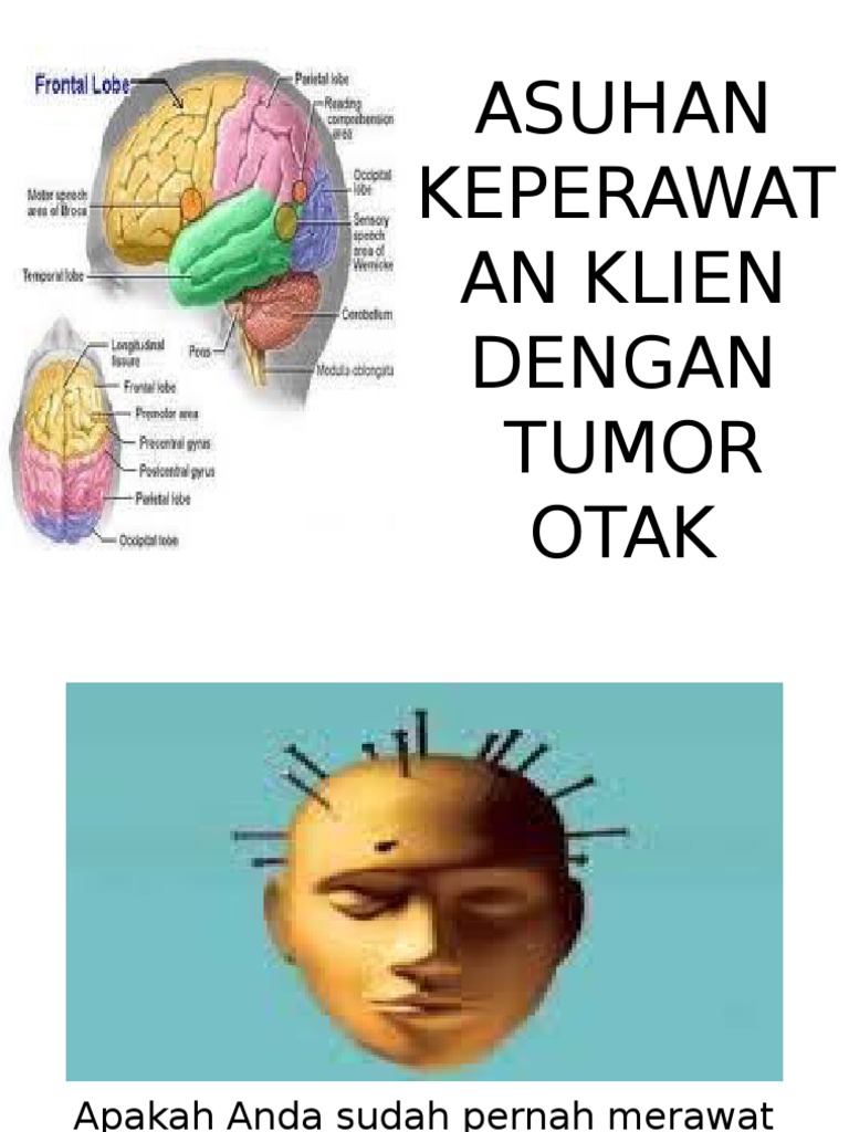 Askep Tumor Otak | PDF