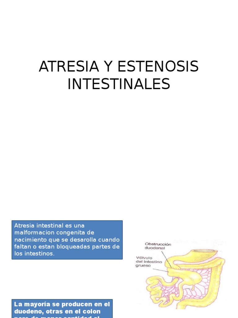 Atresia y Estenosis Intestinales | PDF