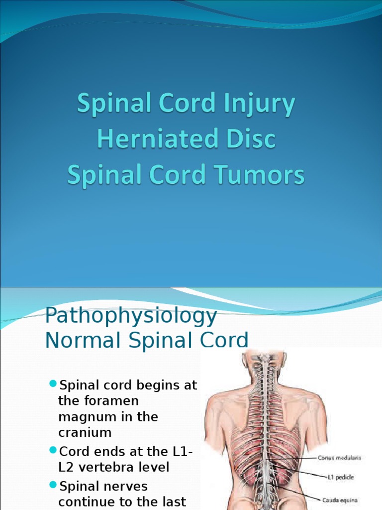 Spinal Cord Injury s2012 | PDF | Vertebral Column | Spinal Cord
