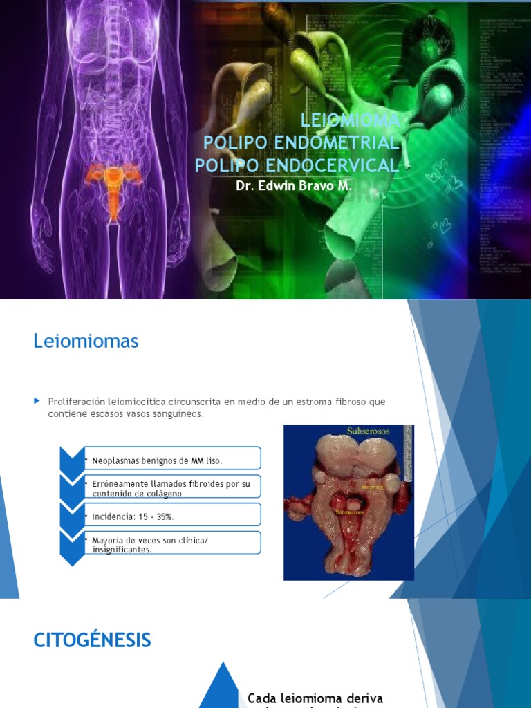 POLIPO ENDOCERVICAL | El embarazo | Anatomía