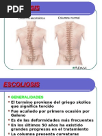 Signo de Risser | PDF | Escoliosis | Rtt