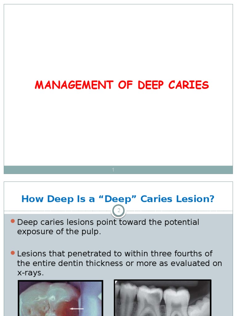 Deep Caries Management Guidelines | PDF | Dentin | Mouth