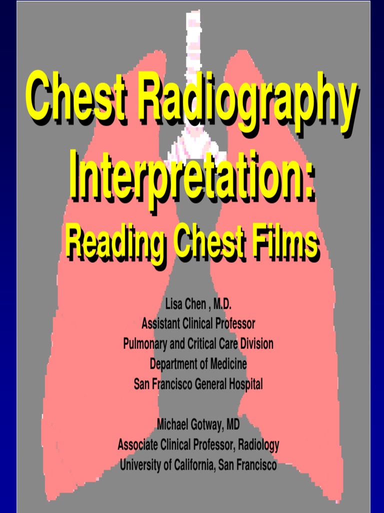 TB Radiography Reading | PDF | X Ray | Lung