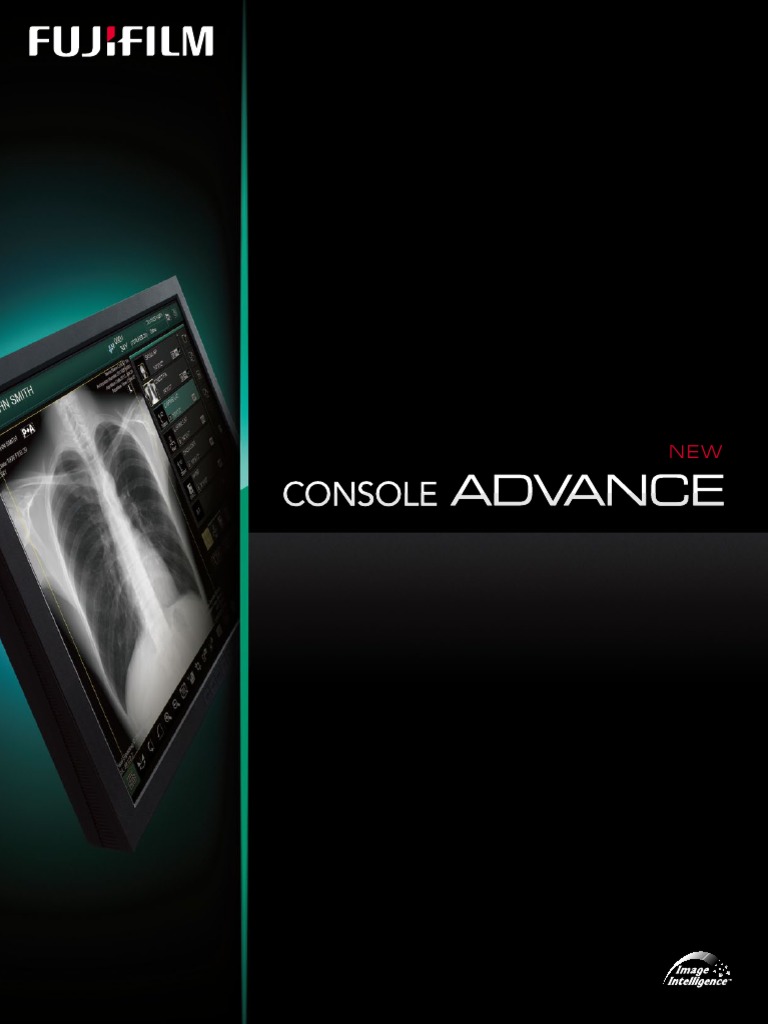 Console Advance | PDF | Computer Monitor | Medical Imaging