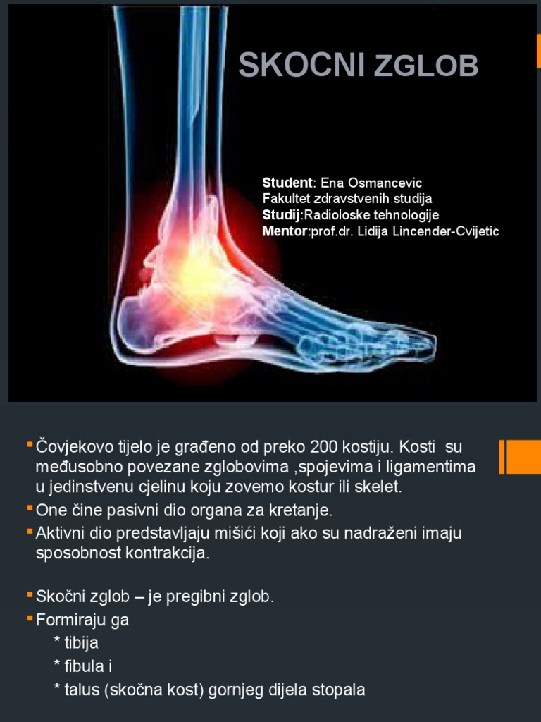 Skocni Zglob | PDF