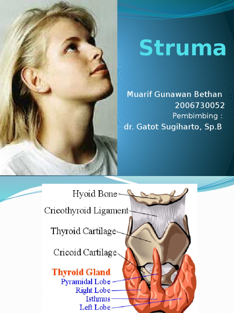 Struma | PDF