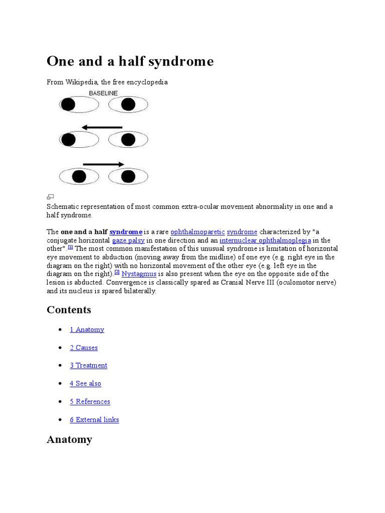 One and A Half Syndrome | PDF | Neuroscience | Vision