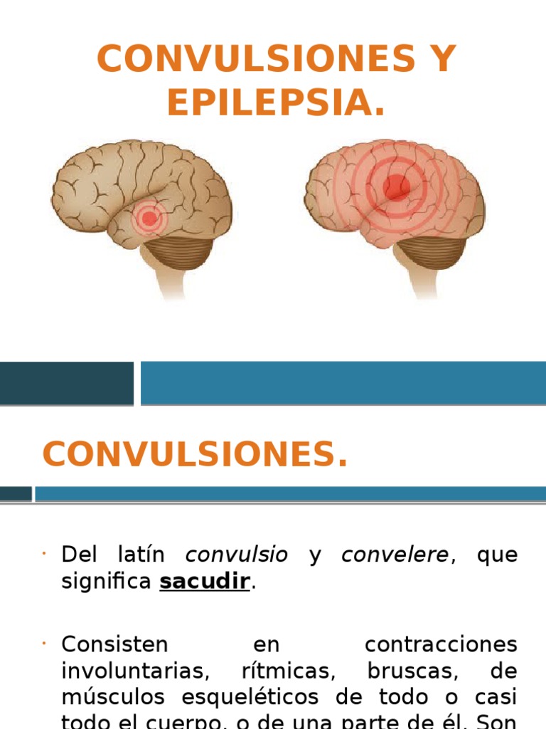 Síndrome Convulsivo, Presentación. | Epilepsia | Desórdenes neurológicos