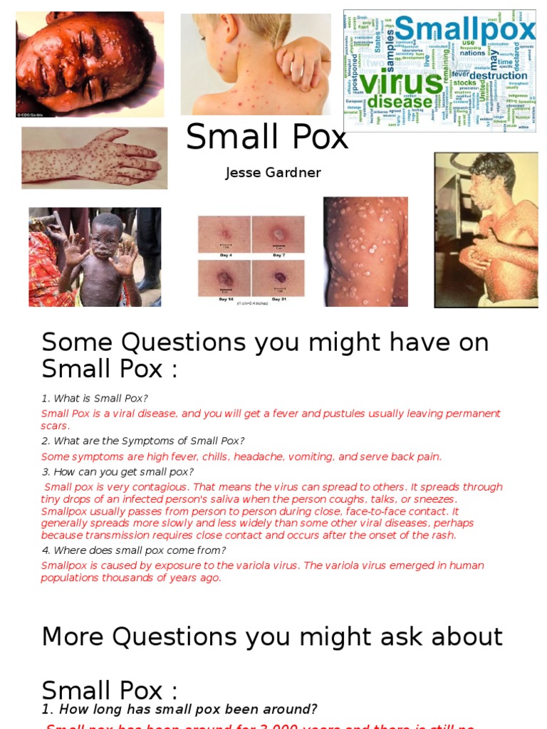 Small Pox | PDF