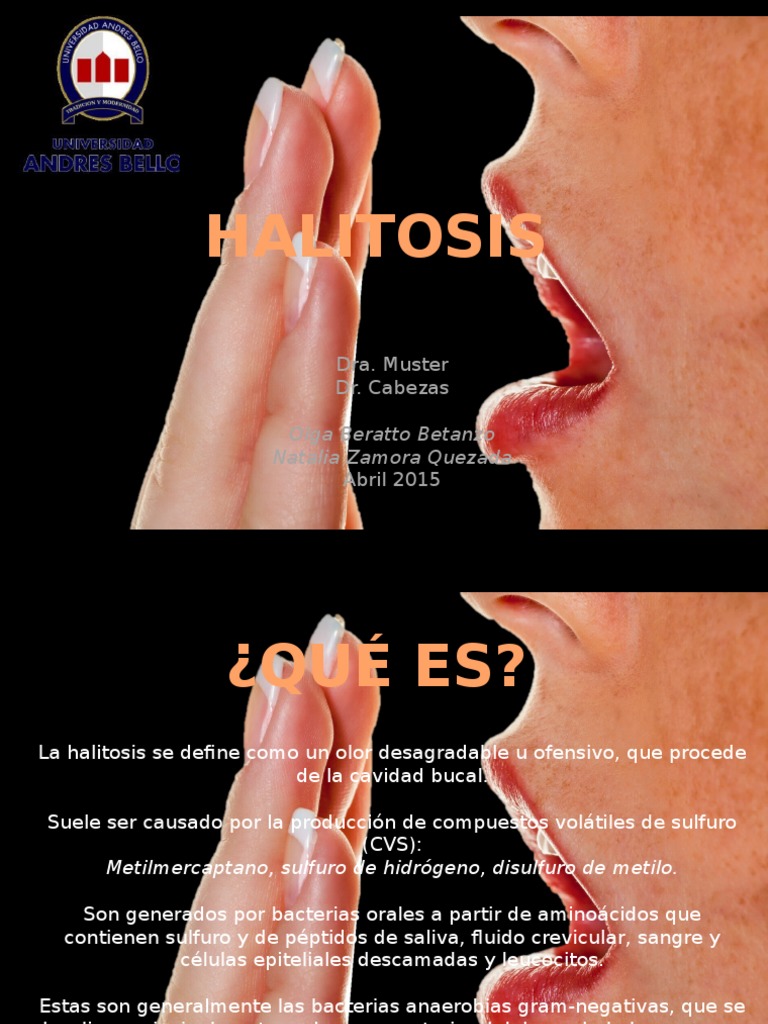 Halitosis | Halitosis | Diente humano