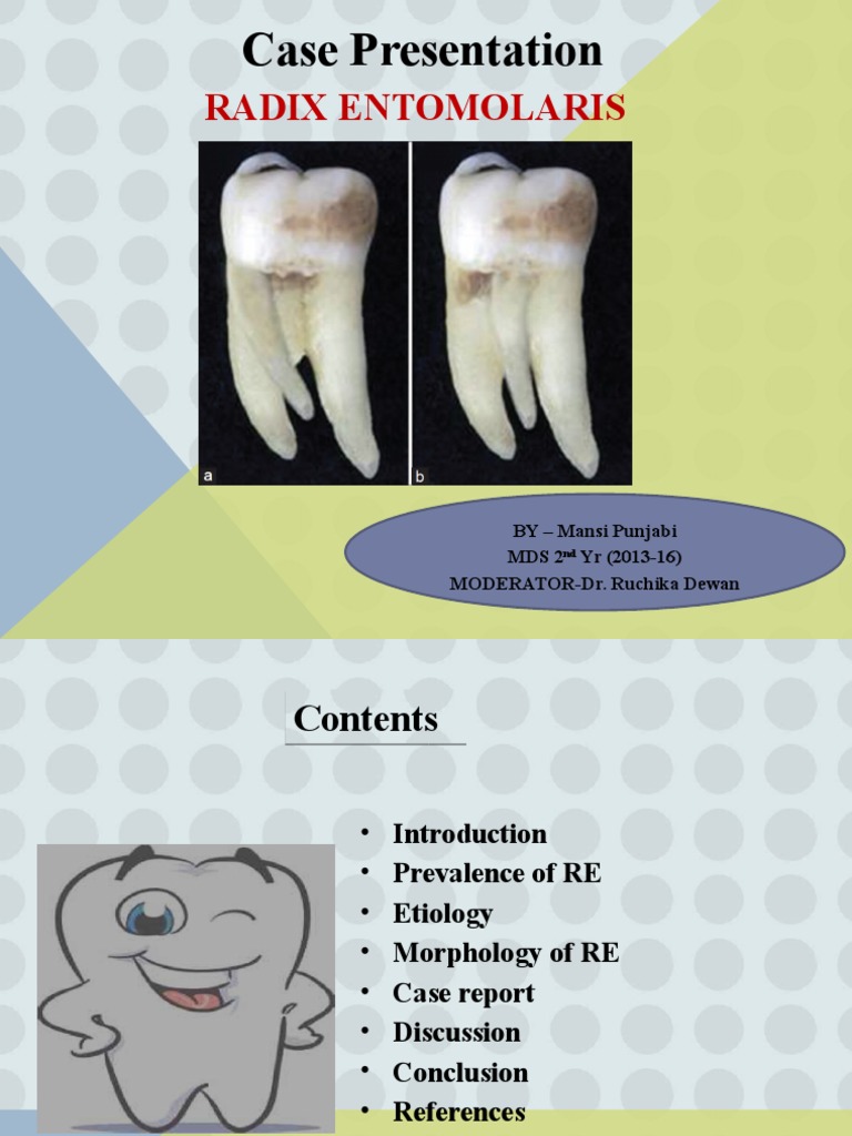 Radix Entomolaris: Diagnosis and Treatment | PDF | Health Care ...