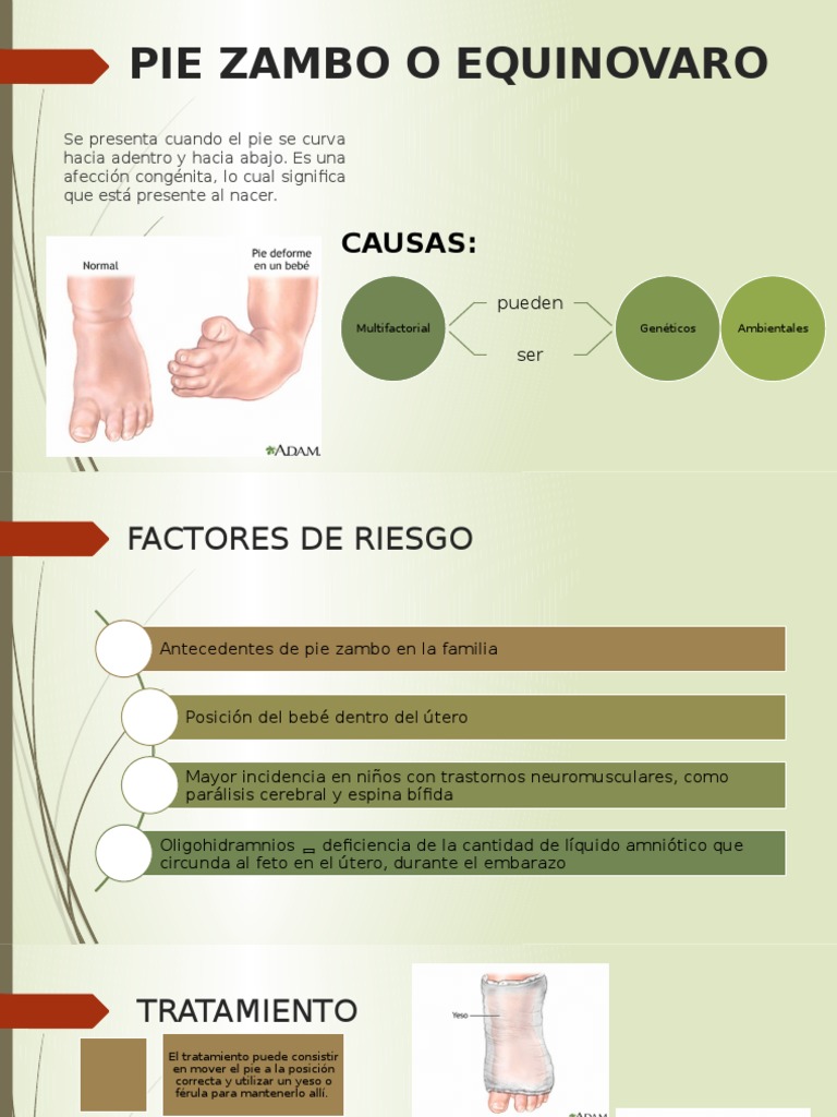 Pie Zambo o Equinovaro | PDF | Vértebra | Anatomía