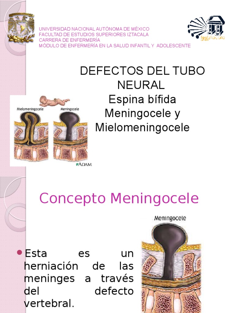 Defectos Del Tubo Neural | Ciencias de la Salud | Bienestar