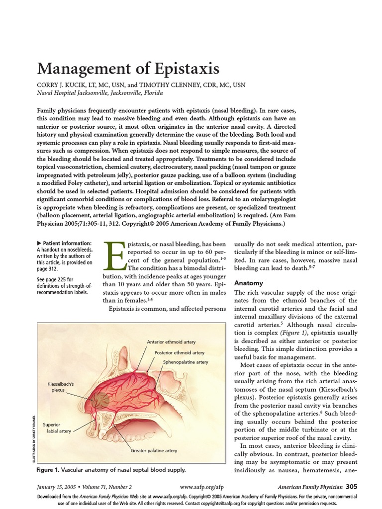 Management of Epistaxis | PDF | Medical Specialties | Medicine