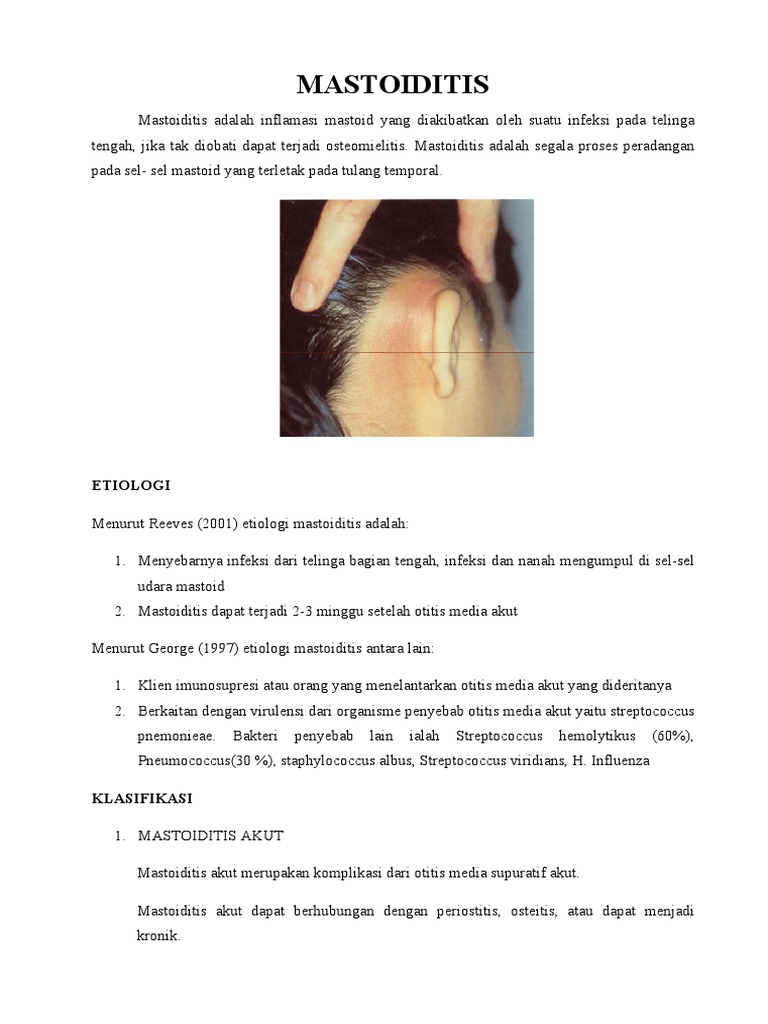 Mastoiditis | PDF | Sains & Matematika