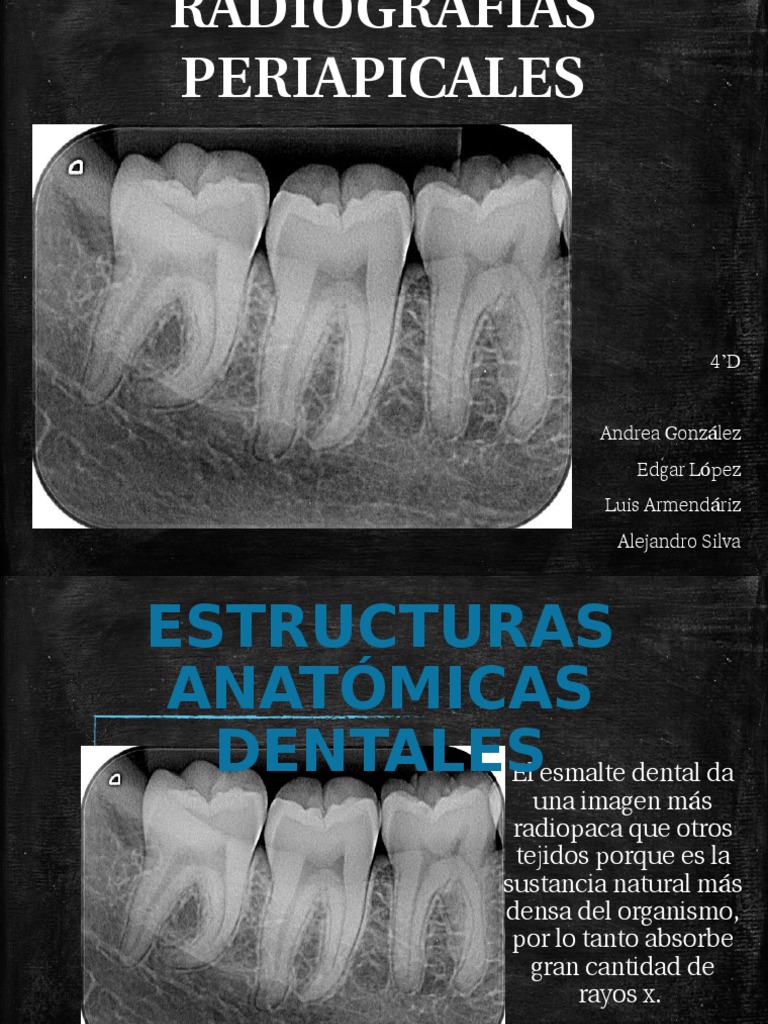 RADIOGRAFIAS PERIAPICALES