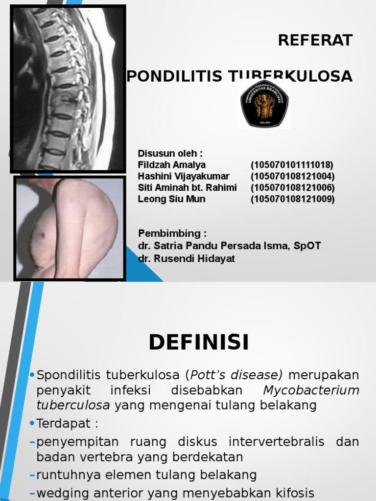 PPT Spondilitis TB