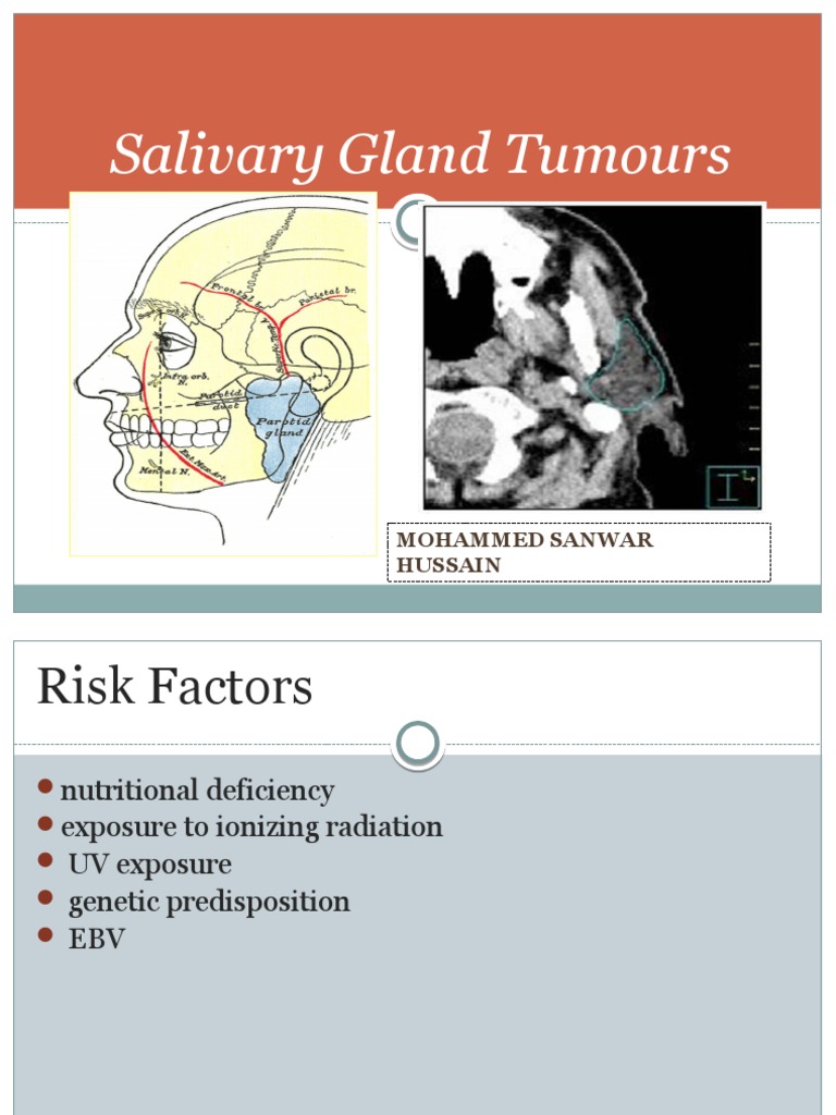 Salivary Gland Carcinoma Presentation | PDF | Adenoma | Neoplasms