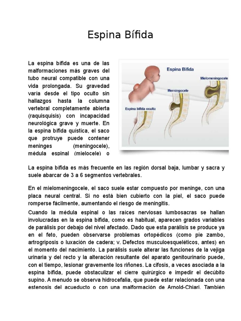 Espina Bífida | Neurología | Medicina