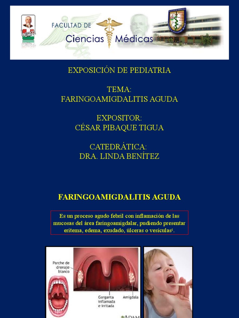 FARINGOAMIGDALITIS | Penicilina | Alergia