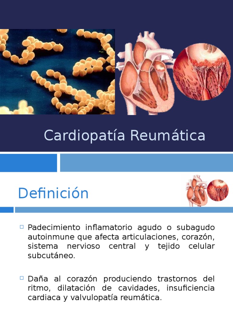 Cardiopatía Reumática | Inmunología | Medicina