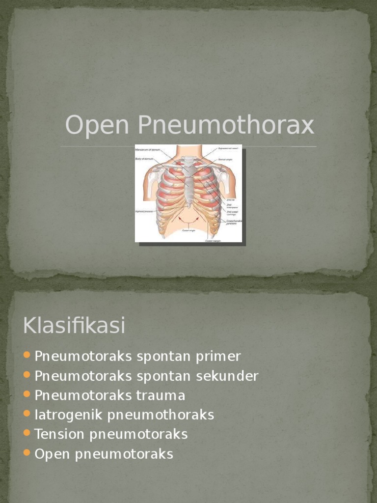 Open Pneumothorax | PDF