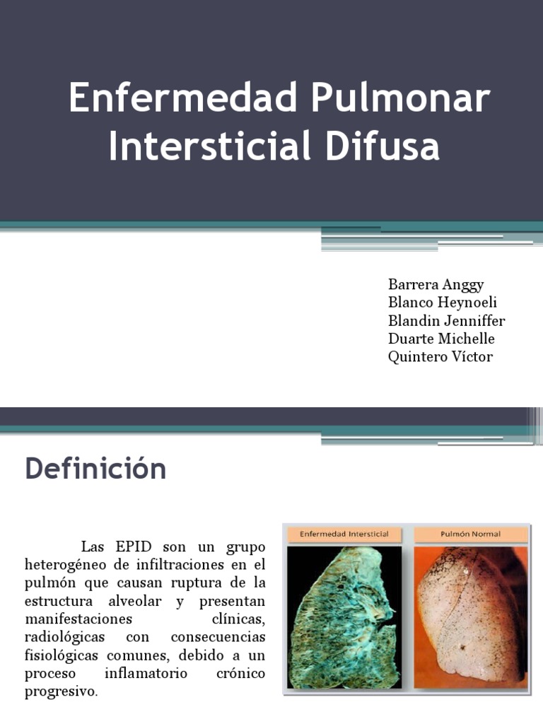 Enfermedad Intersticial Pulmonar Difusa | PDF | Neumonía | Tos