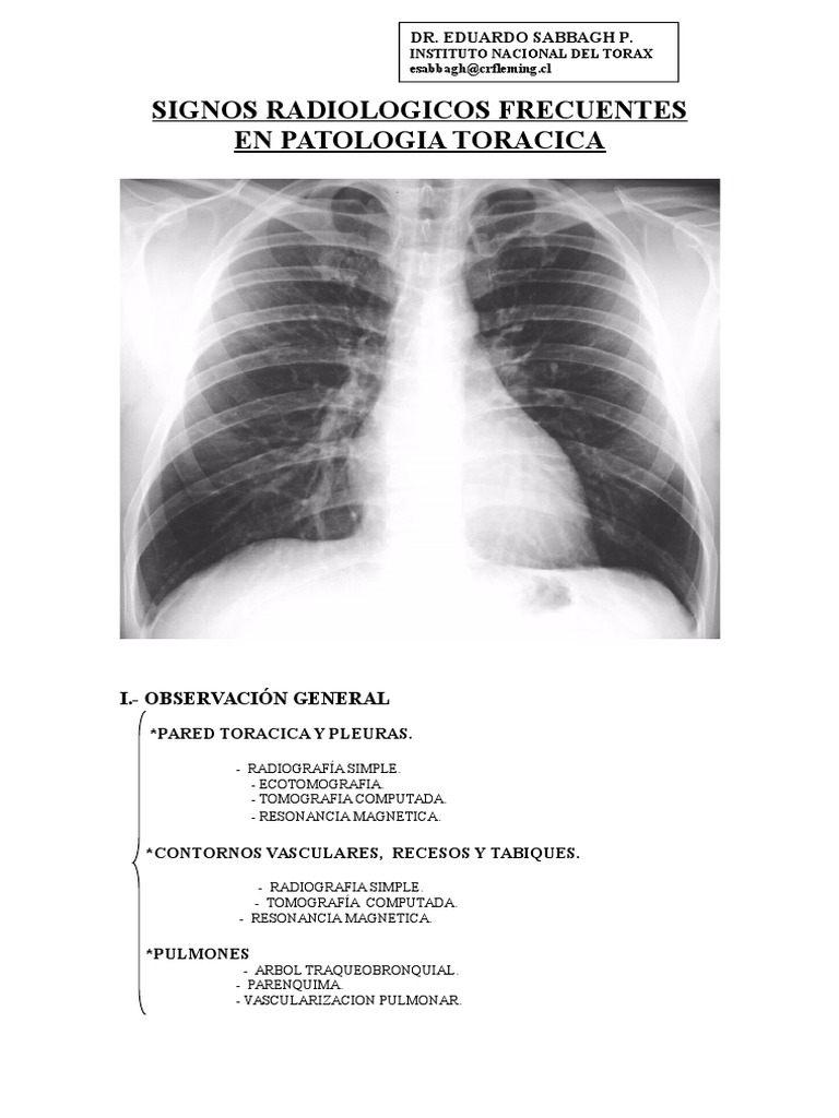Signos Radiologicos Frecuentes | PDF | Pulmón | Sangre