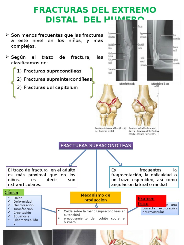 Fx extremo distal del humero.pptx | Codo | Sistema musculoesquelético
