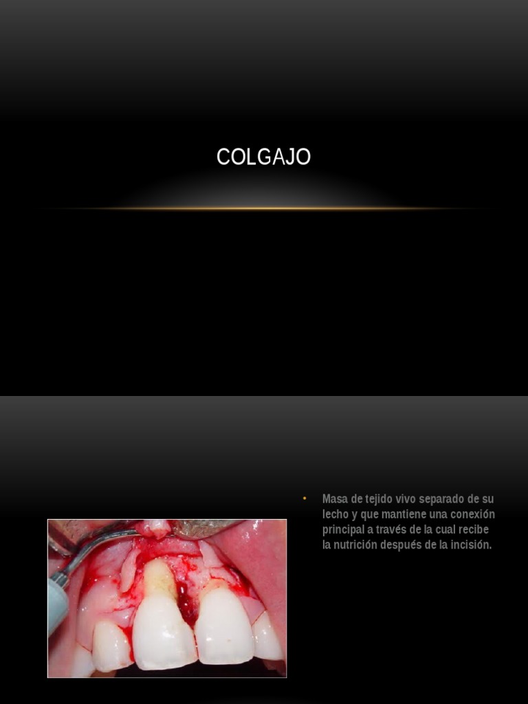 Colgajo | PDF | Cirugía | Cirugía Oral y Maxilofacial