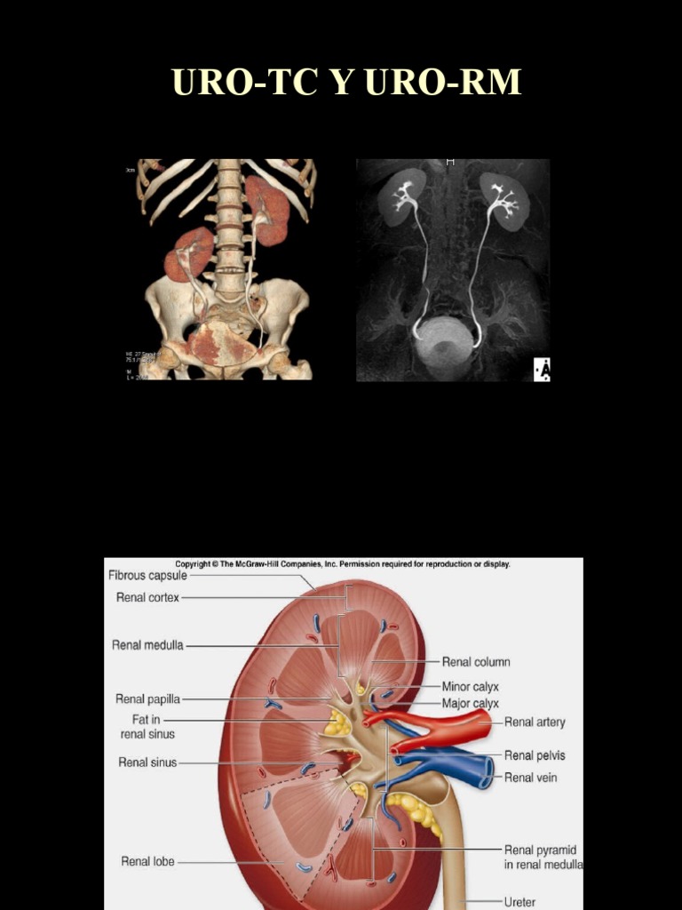 Uro-Tc y Uro-Rm | PDF | Riñón | Sistema urinario