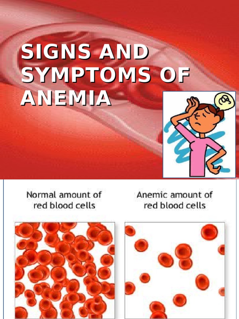 Anemia: Signs and Symptoms Explained | PDF | Anemia | Blood