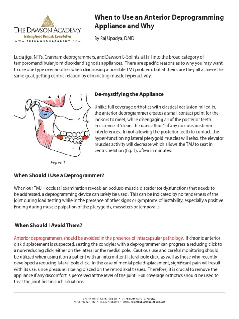 When To Use An Anterior Deprogramming Appliance and Why: De-Mystifying ...