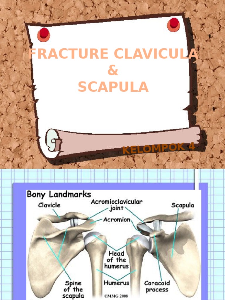 2.2 Fraktur Clavicula &scapula | PDF