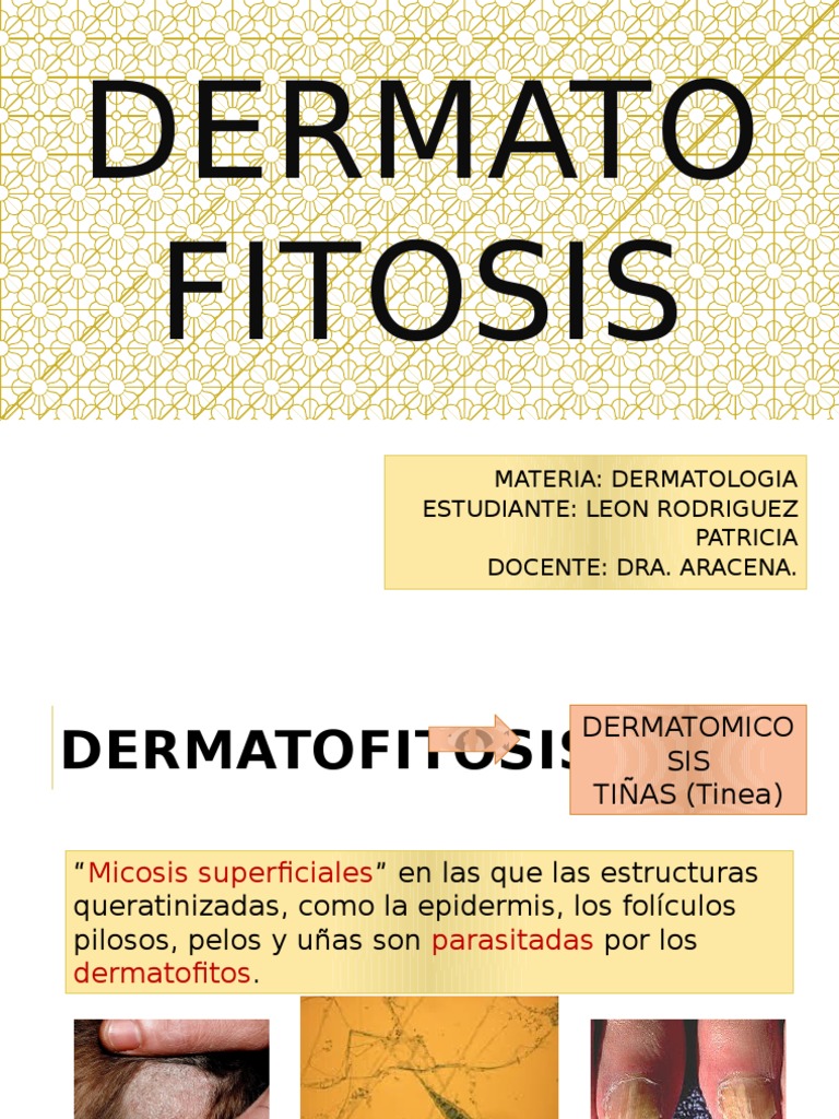 Dermatofitosis: Diagnóstico y Tratamiento | PDF | Inmunología ...