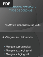 Líneas de Terminación | PDF | Dentadura postiza | Diente