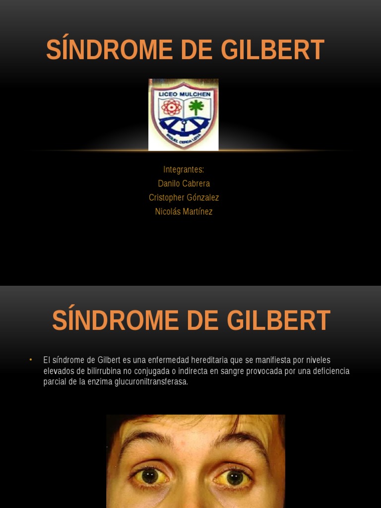 Sindrome Gilbert | PDF
