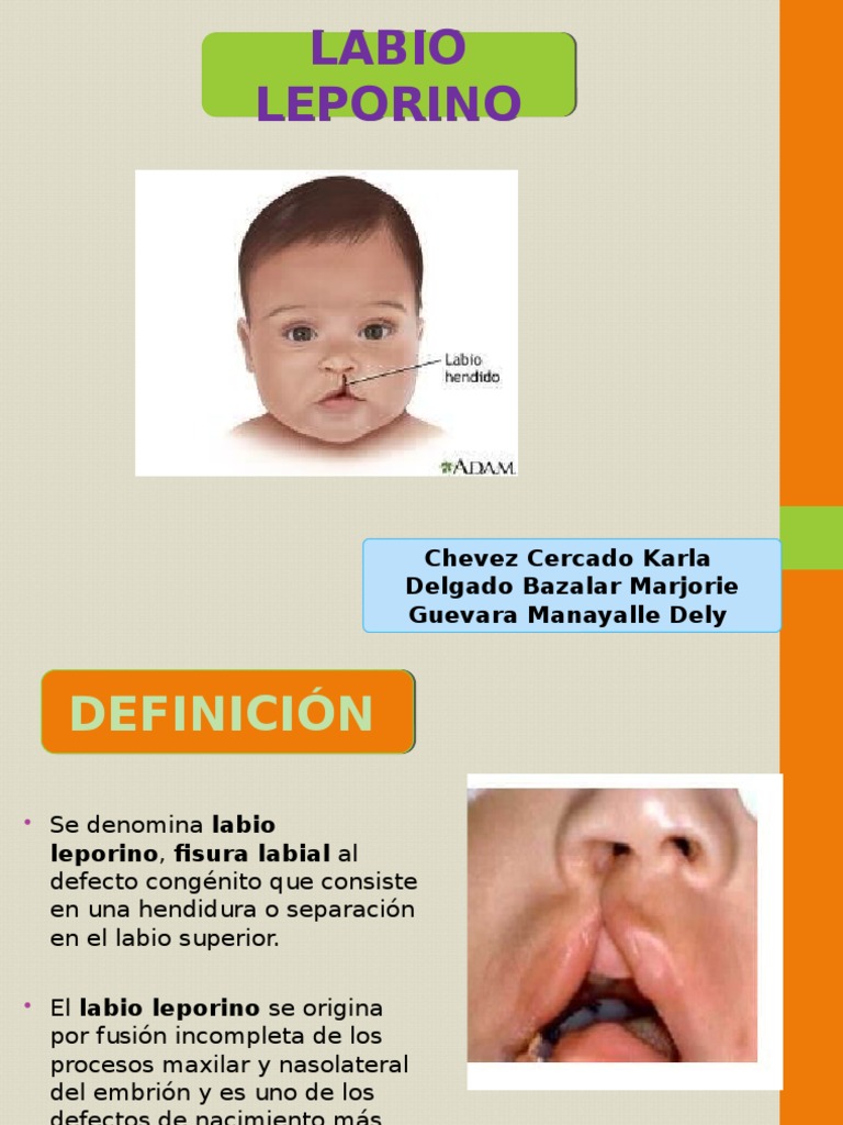Labio Leporino | PDF