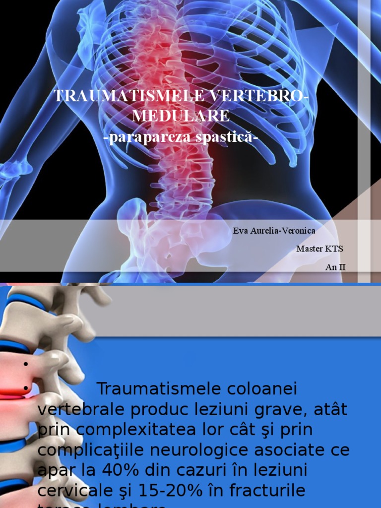 Parapareza Spastica | PDF