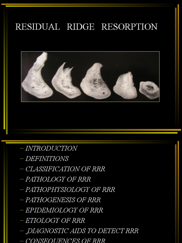 Residual Ridge Resorption Classifications | PDF | Dental Implant | Bone