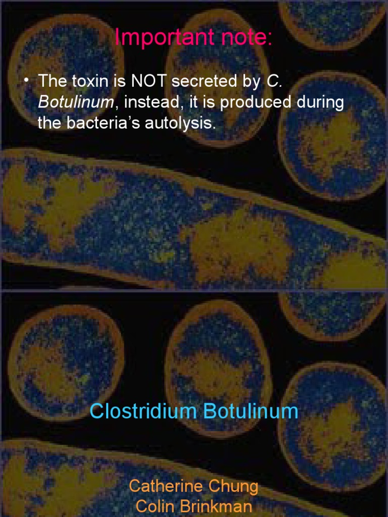 Botulinum Presentation.ppt | Botulinum Toxin | Biological Warfare