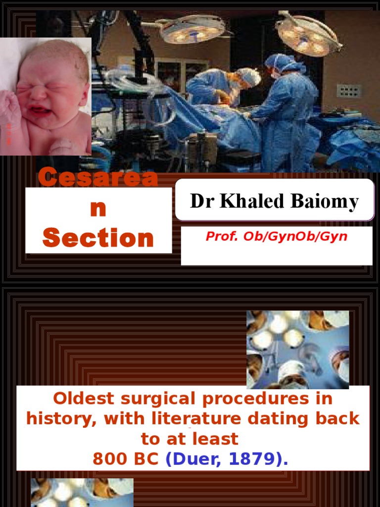 Cesarean Section Pdf Caesarean Section Uterus