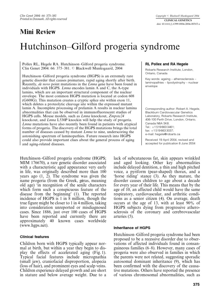 Hutchinson-Gilford Progeria Syndrome: Mini Review | PDF