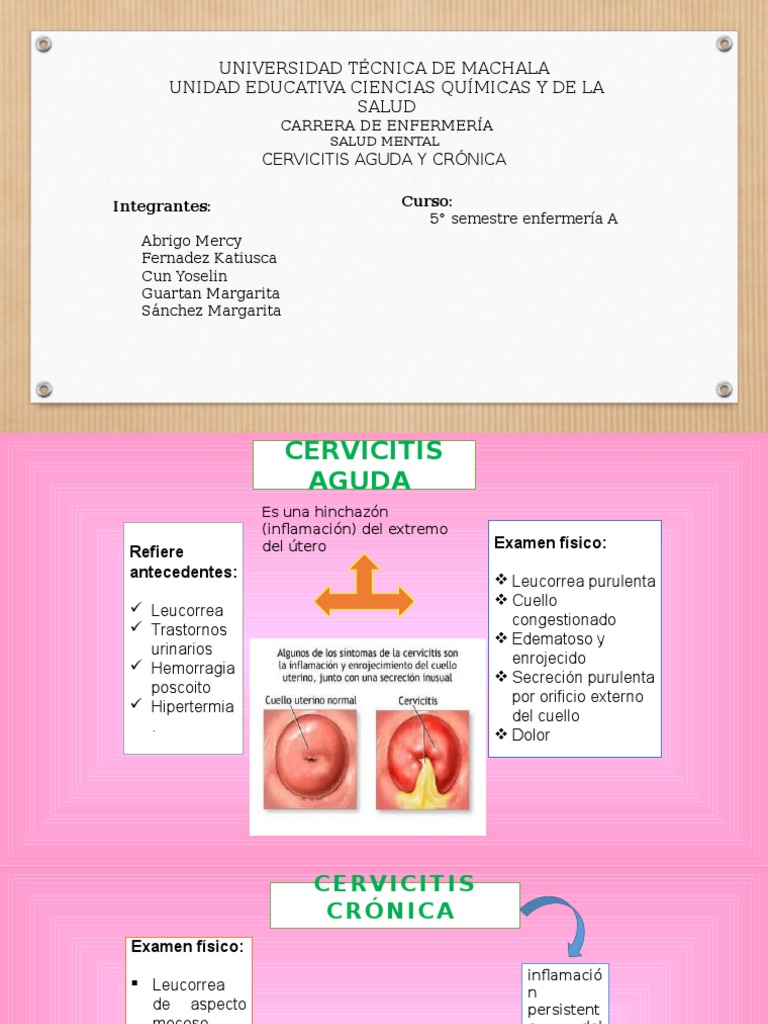 Cervicitis Aguda y Cronica | Útero | Enfermedades y trastornos