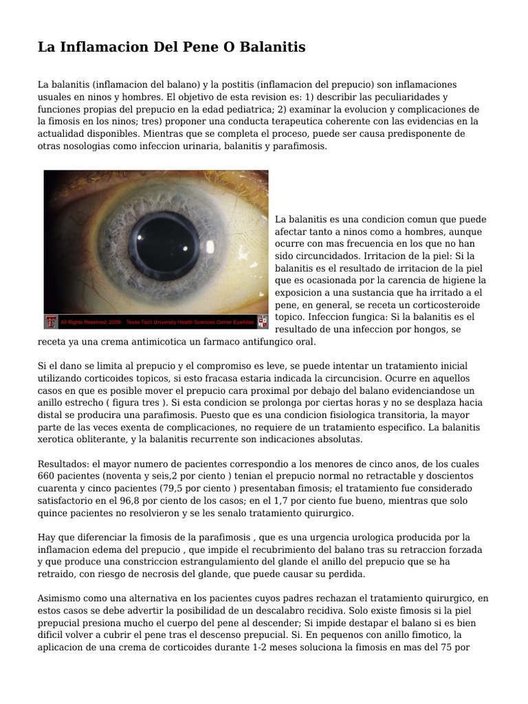 La Inflamacion Del Pene O Balanitis | PDF | Sistema genitourinario ...